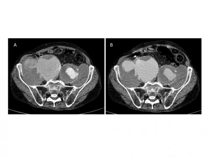 TRAUMA VASCULAR – Imagen Vascular